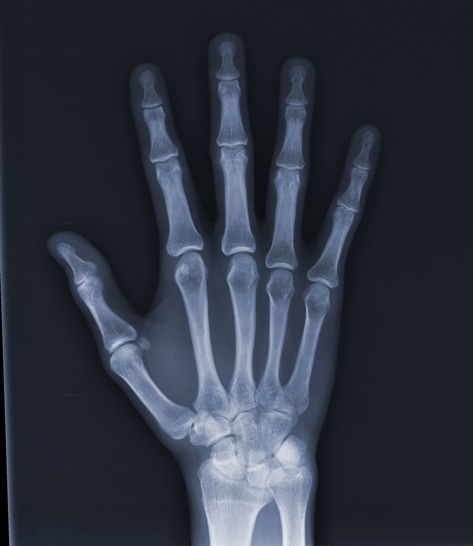 Radiografías de mano - Clínica Magnasalud (Valencia)