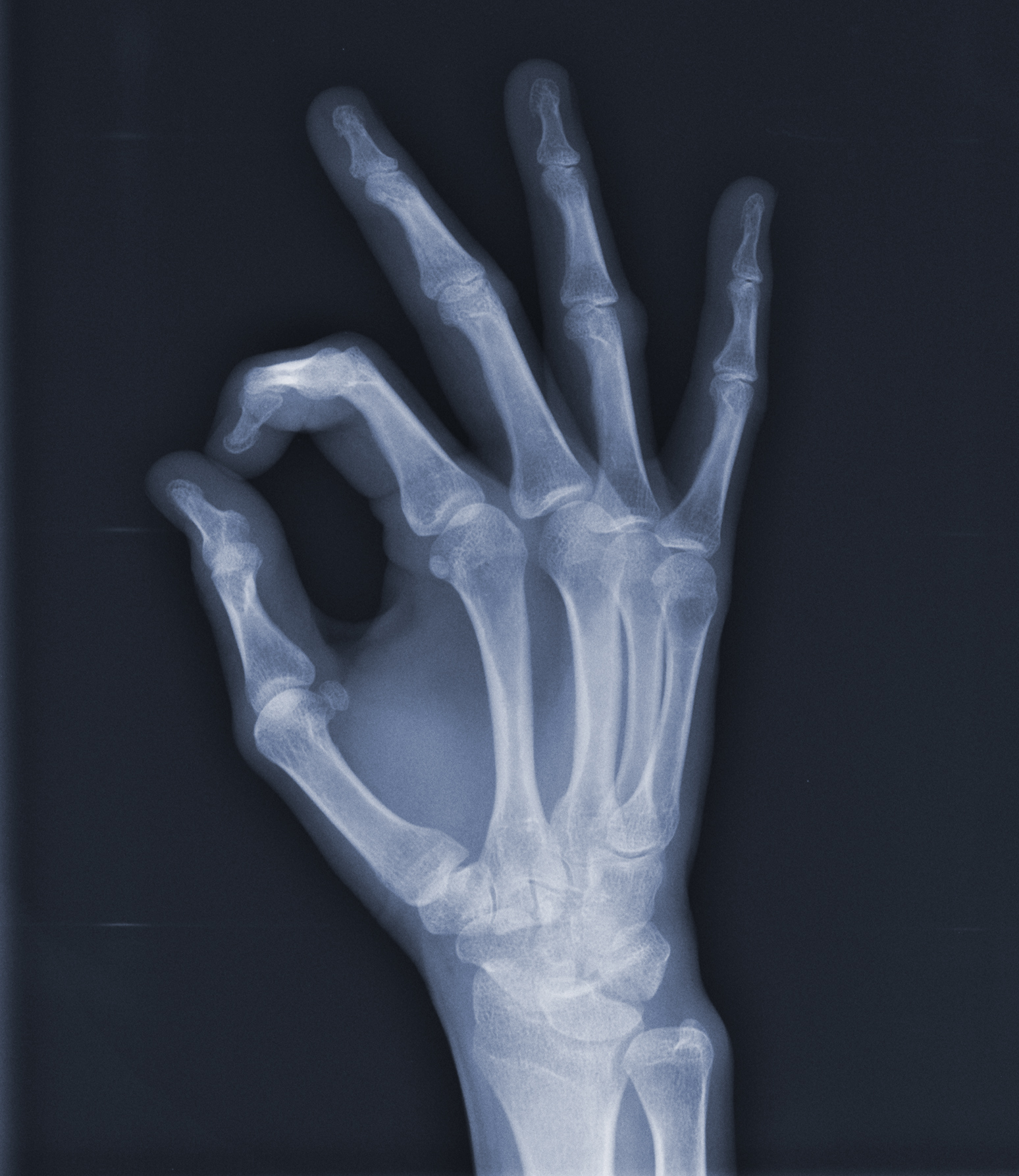 Radiografías de mano - Clínica Magnasalud (Valencia)