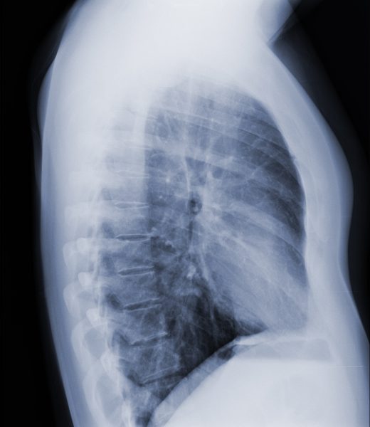 Radiografia de tórax - Clínica Magnasalud (Valencia)